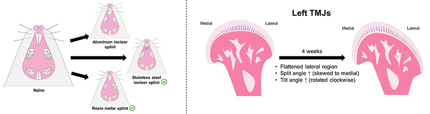 Mandibular condylar process remodeling in rats with different bite ...